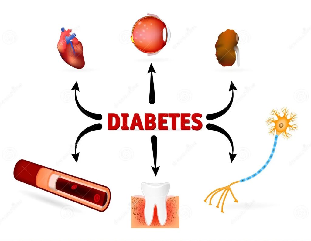 7 Ways Diabetes Affects Your Body - Doctor Benjamin Díaz Curiel