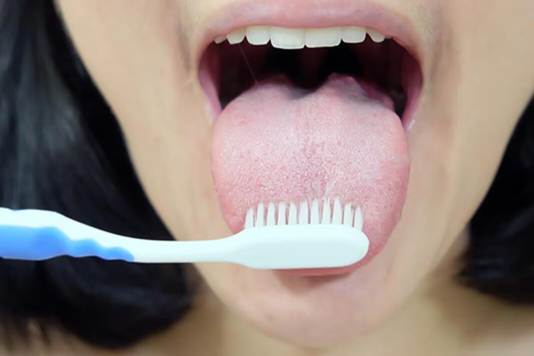 ¿De qué color es tu lengua? ¿Qué está sano y qué no? - Doctor Benjamin ...