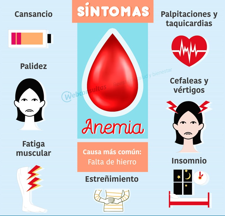 ¿Pasa por alto los signos sutiles de la anemia? - Doctor Benjamin Díaz ...