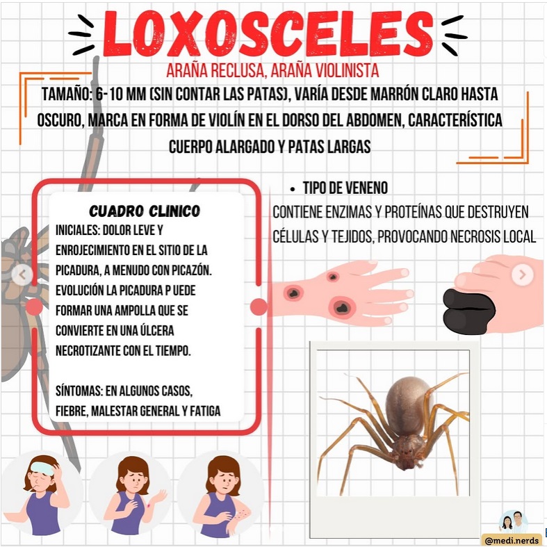Cómo tratar las picaduras de araña y cuándo acudir al médico - Doctor ...