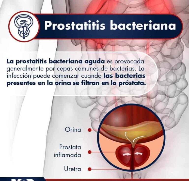 ¿Qué es la prostatitis y cómo se trata? - Doctor Benjamin Díaz Curiel