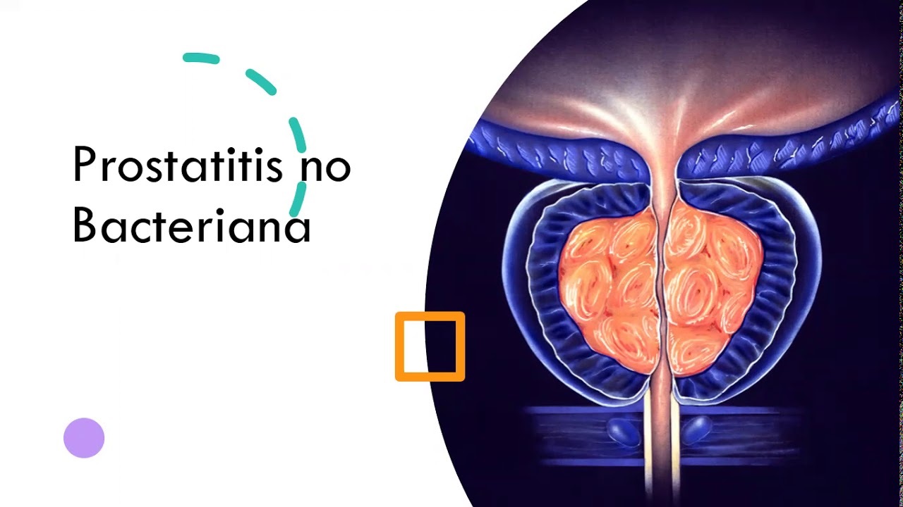 ¿Qué es la prostatitis y cómo se trata? - Doctor Benjamin Díaz Curiel